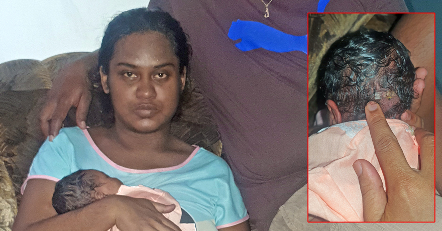 Un nouveau-né blessé à la tête par les forceps - Son père, Jason Thomas ...